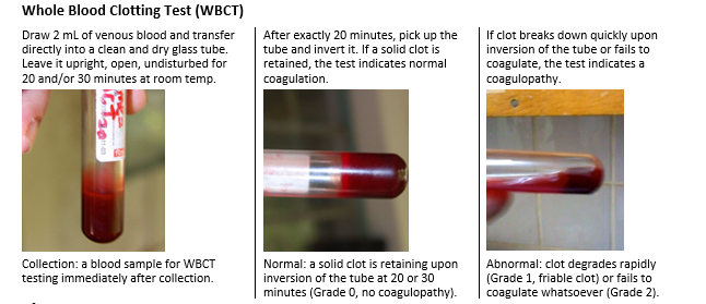 Global Snake Envenomation Management