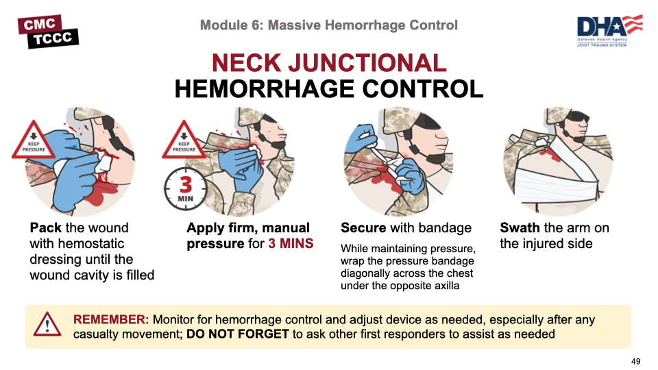 Module 6: Massive Hemorrhage Control